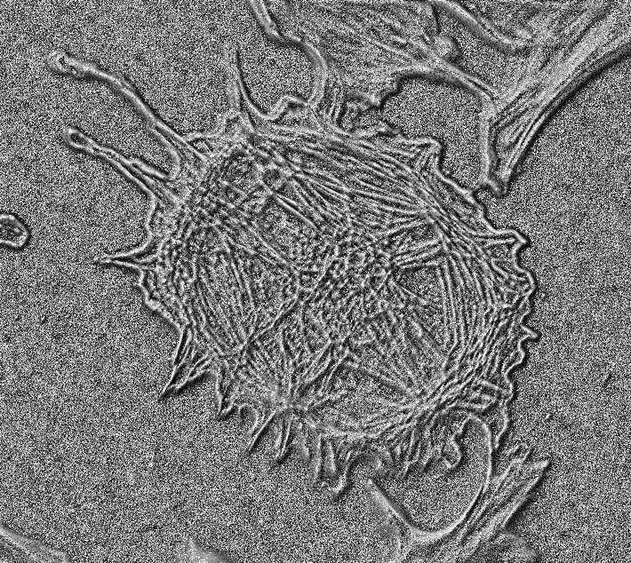 local linear contrast adjust